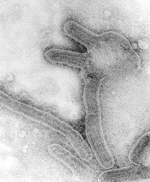 Scientists identify Green Monkey disease as responsible for more than ...